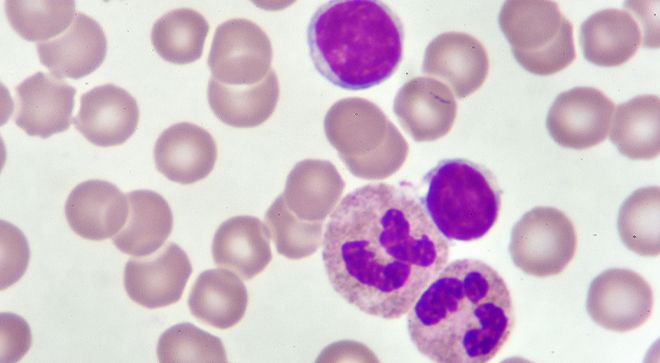 When and How CLL, SLL Should Be Treated