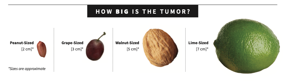 Figure, Tumor Sizes Are Often PDQ Cancer Information , 46% OFF
